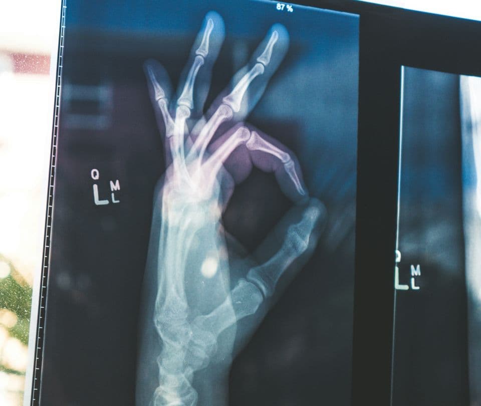 What is group income protection | Eleos